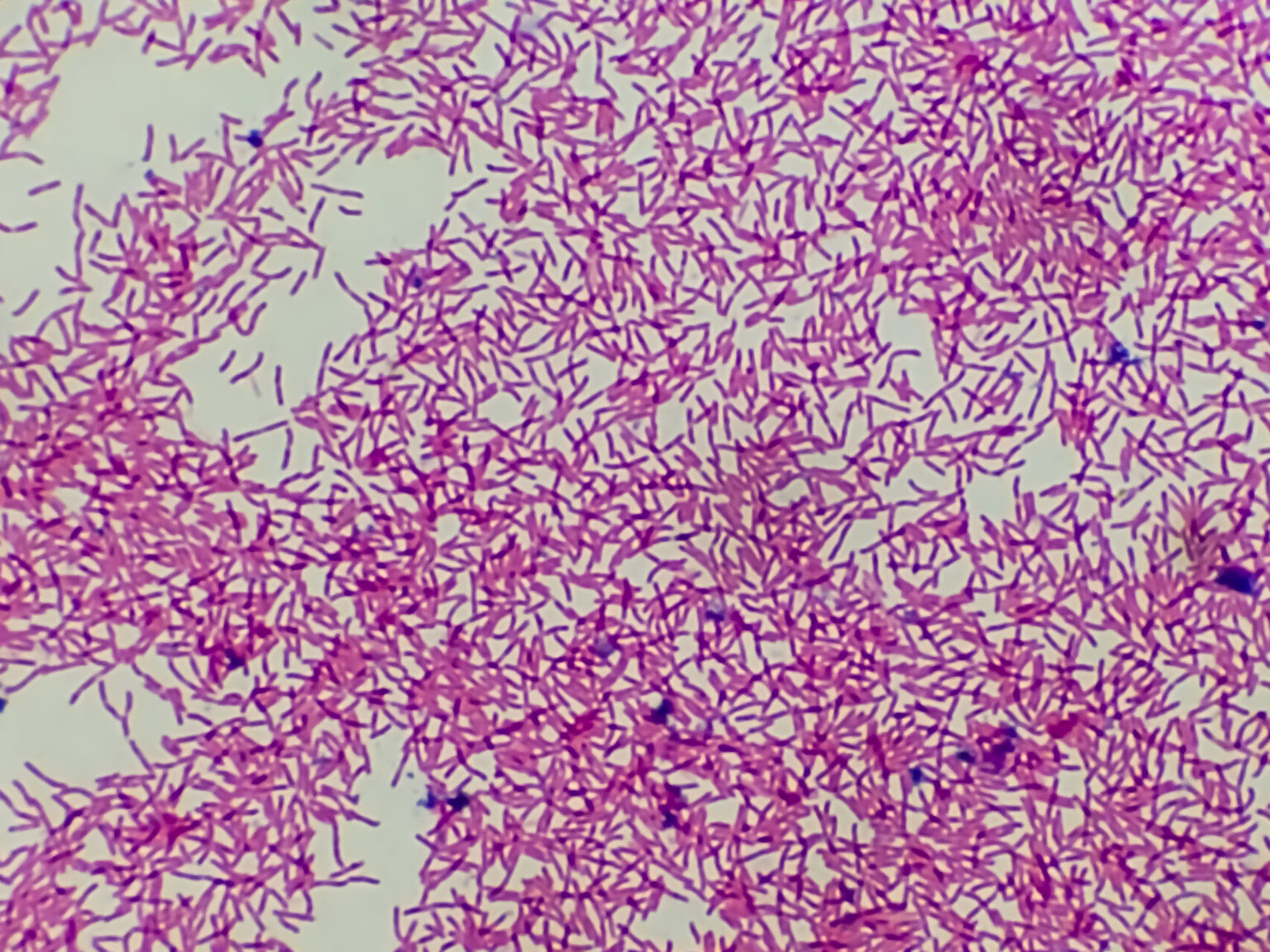 Mammalian or Microbial? Considerations When Choosing an Expression ...